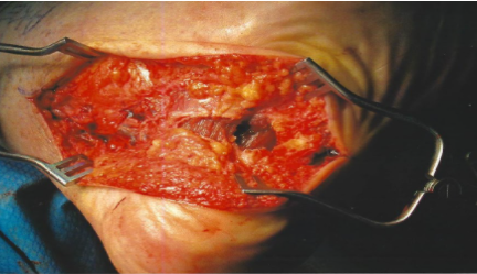 The Operation Was Successful